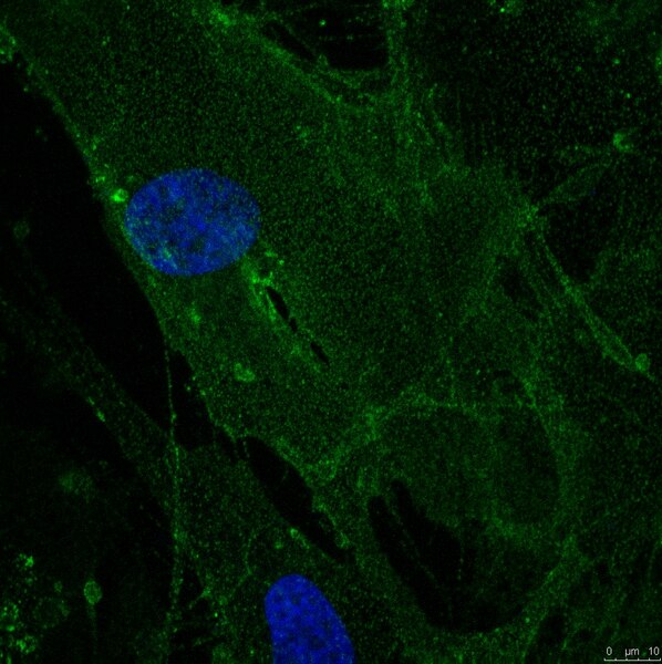 Anti-Integrin alpha 5 (CD49e) Antibody, clone mAb16 | MABT820